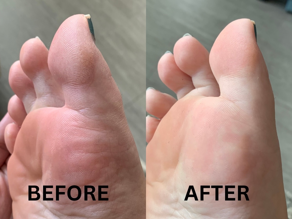 Freeman Foot Peeling Spray Just $4.67 Shipped on Amazon | Great Reviews ...